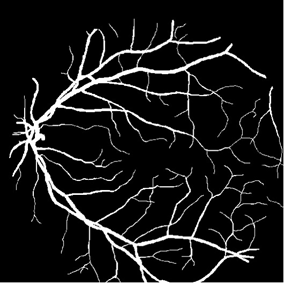 GitHub - DeepakSethupathy/Retina-blood-vessel-segmentation-using-UNET ...