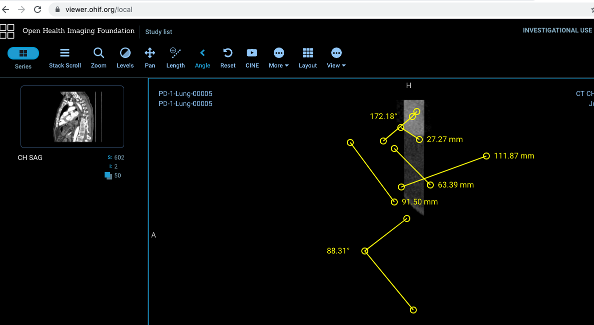 Can I get ViewerLocalFileData to open a fully-fledged instance of the ...