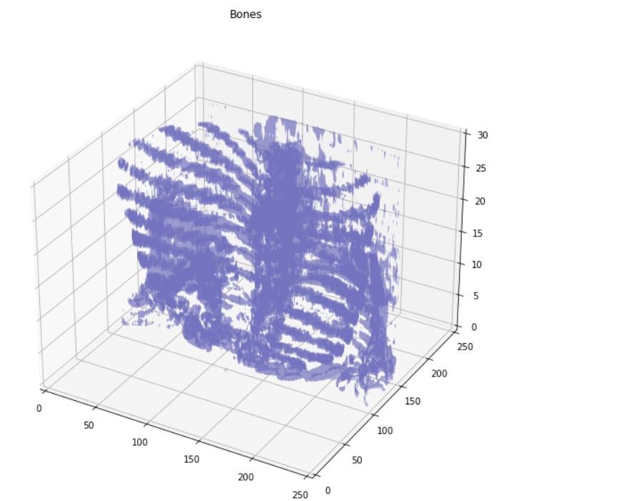 GitHub - Visra07/3D-Structure-Surface-Modelling-from-Volumetric-CT-Images-