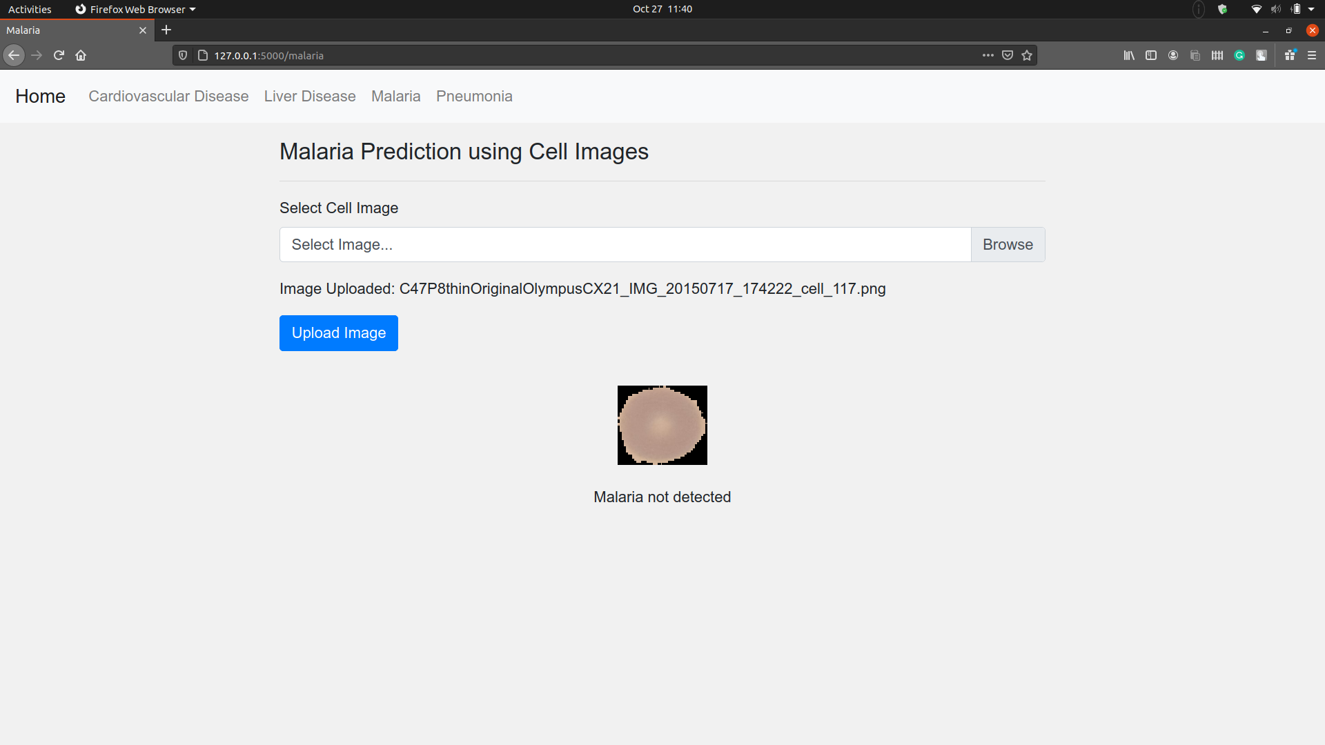 GitHub - MasterKinjalk/Pneumonia-and-Malaria-detection