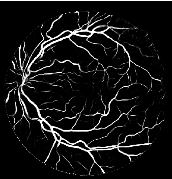 GitHub - Hridoy-bit/Image-segementation-using-modified-u-net-architecture: It is a projects for ...