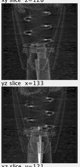 Continually changing rotation center · Issue #469 · tomopy/tomopy · GitHub