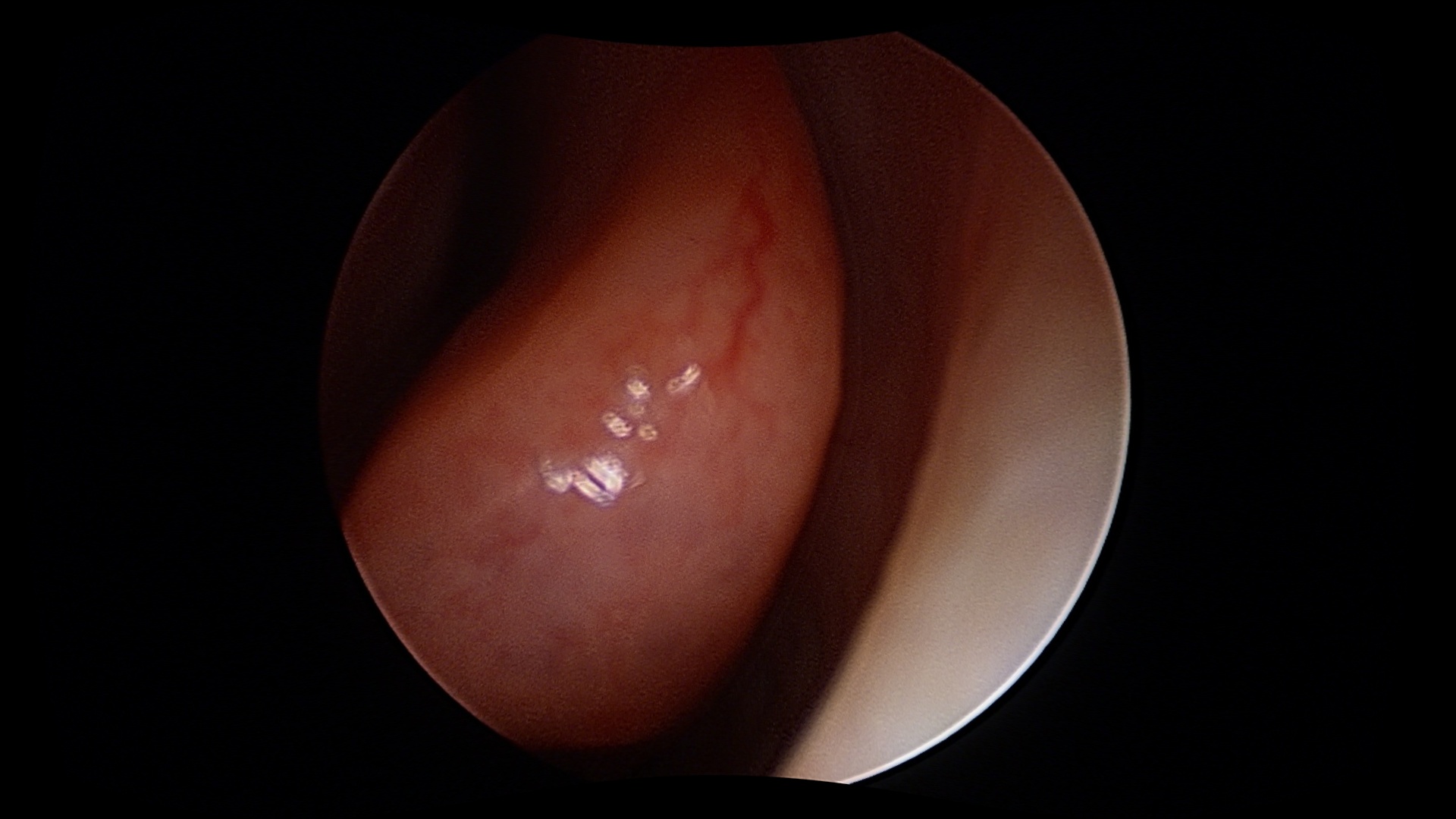 Model Description And Usage · Issue 2 · Uz Slamlabendo Depth And Motion · Github