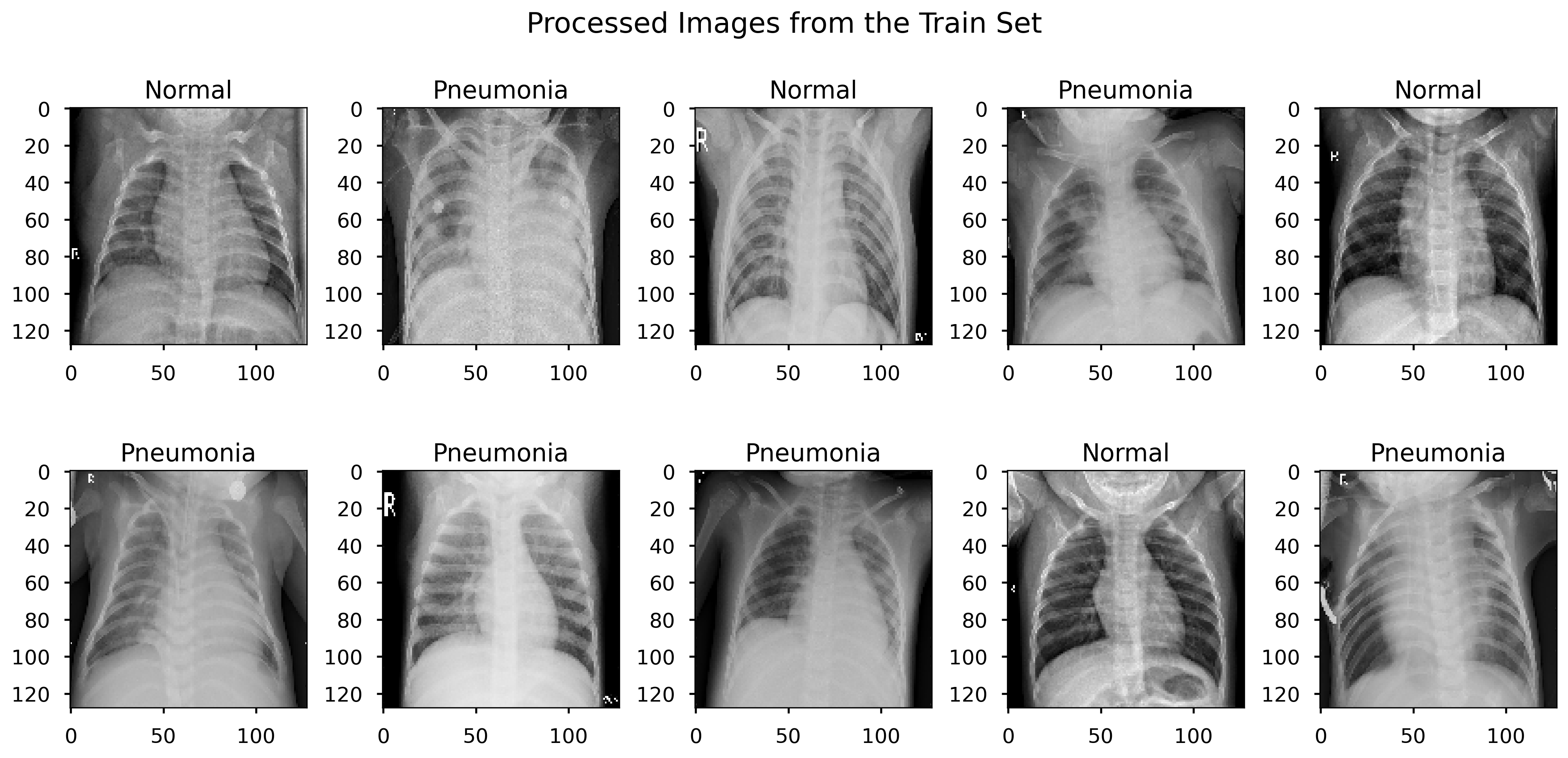 GitHub - erdemiraysu/Image-Classification-with-DeepLearning: Image Classification of Pneumonia ...