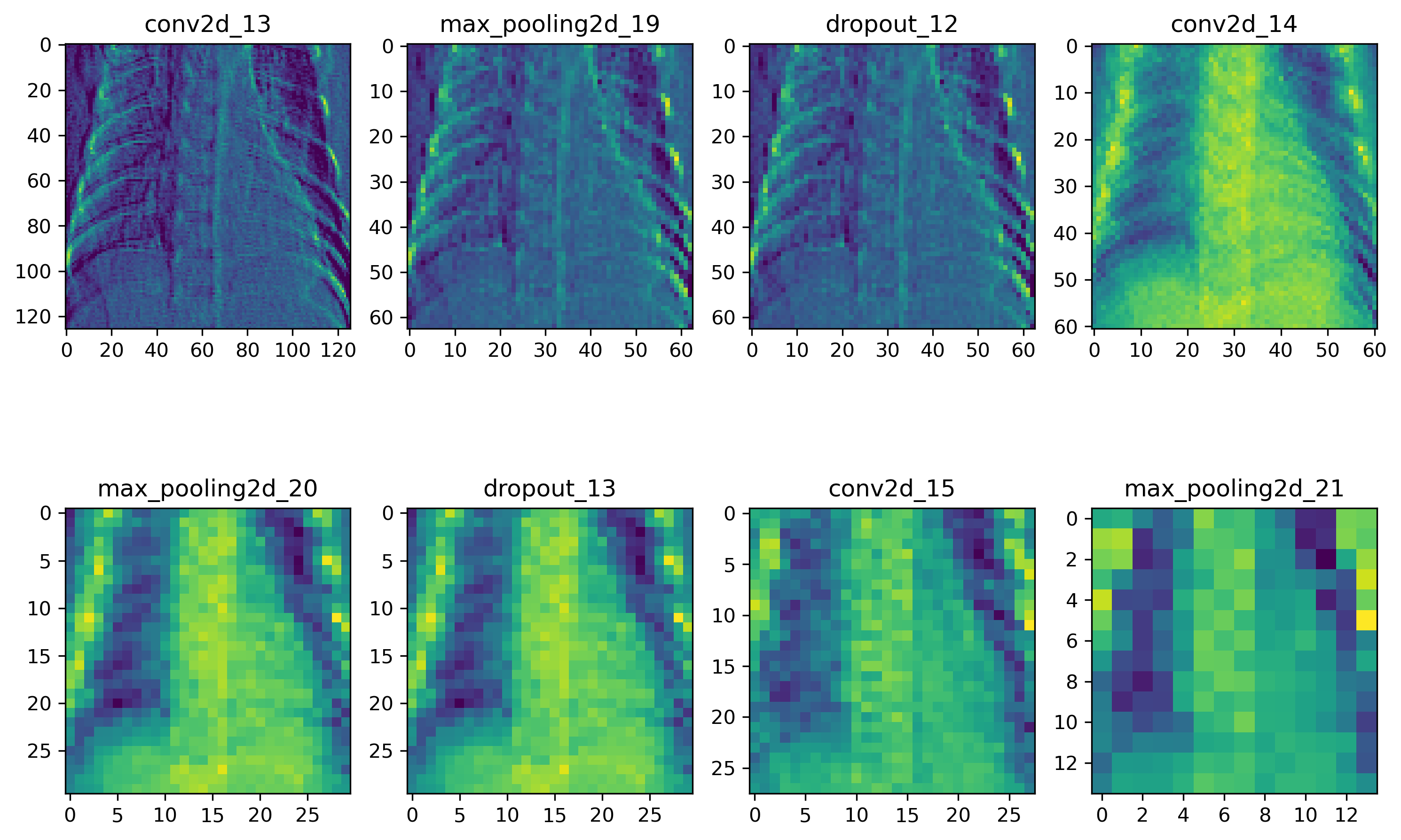 Github Erdemiraysu Image Classification With Deeplearning Image Classification Of Pneumonia
