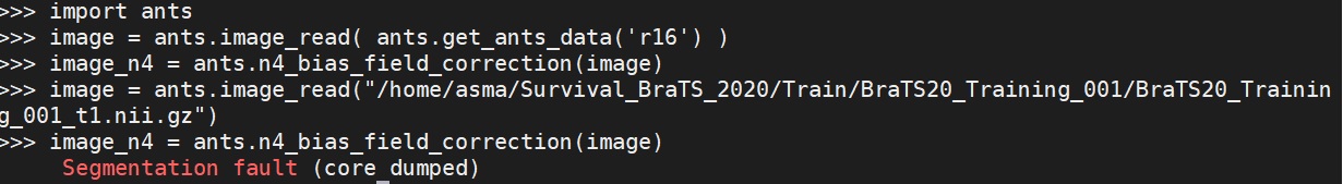 n4 bias correction error · Issue #290 · ANTsX/ANTsPy · GitHub