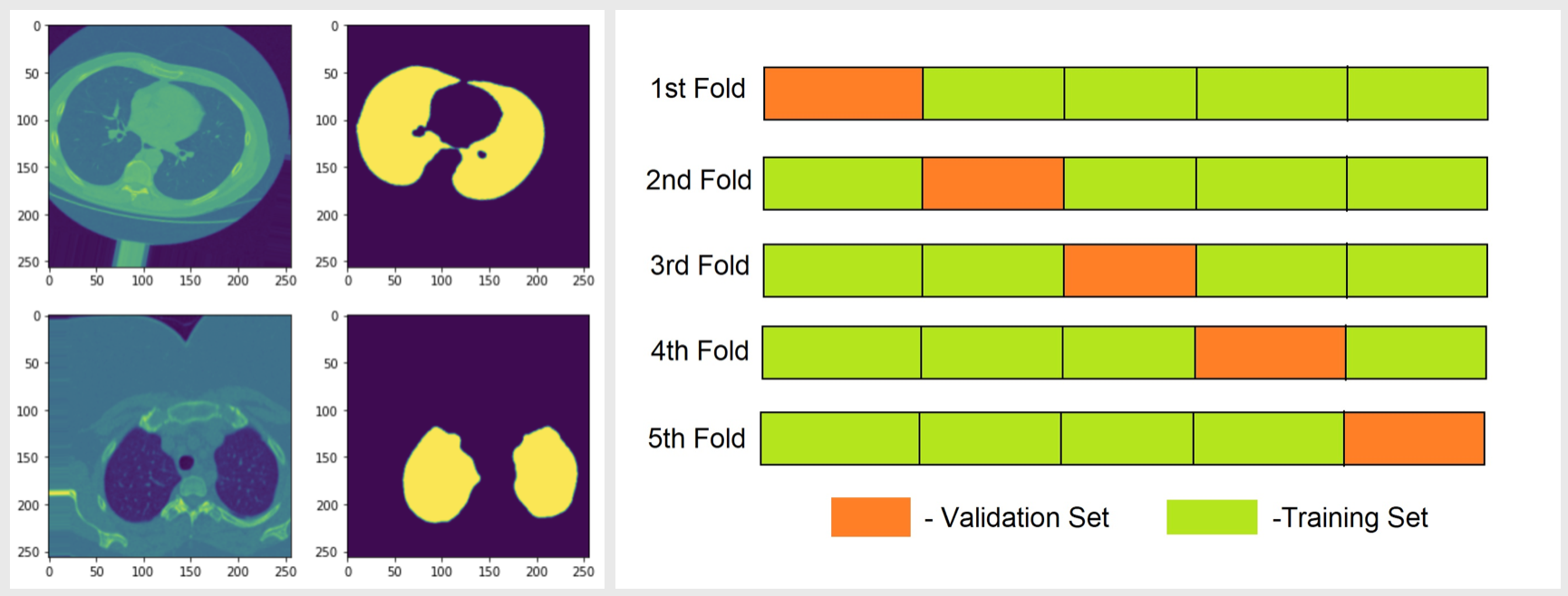 GitHub - rmsgn100/FCN_vs_UNET