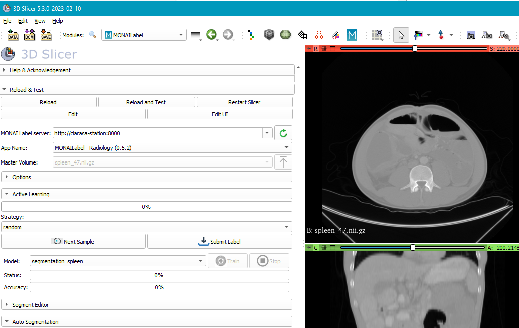 Label Reviewer Not loading · Issue #1300 · Project-MONAI/MONAILabel ...
