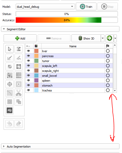Slicer Segment Editor List Is Too Small · Issue 1384 · Project Monai Monailabel · Github