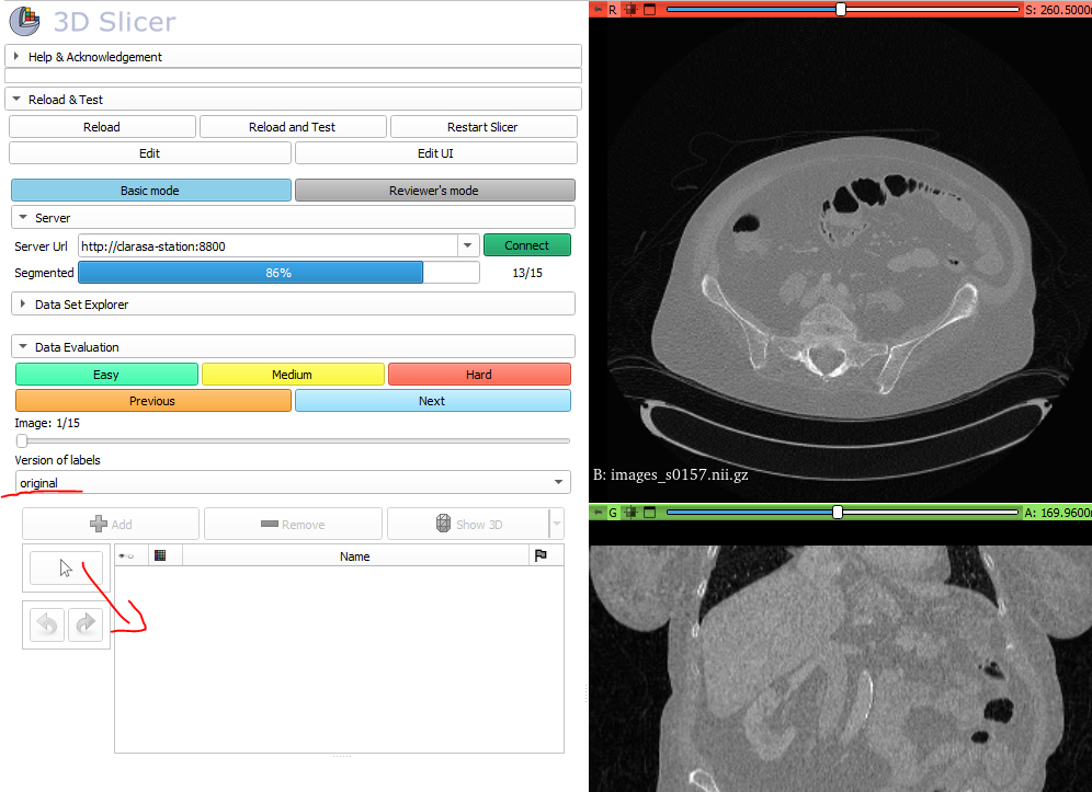 Label Reviewer Plugin Doesnt Load Labels · Issue 1432 · Project Monai Monailabel · Github