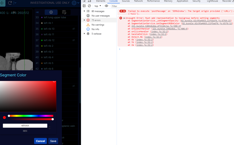 OHIF V3 MONAI Plugin: cannot change label color · Issue #1563 · Project-MONAI/MONAILabel · GitHub