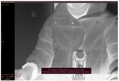 GitHub - monk1108/Endoscope-Image-Acquisition-and-Management-System: A ...