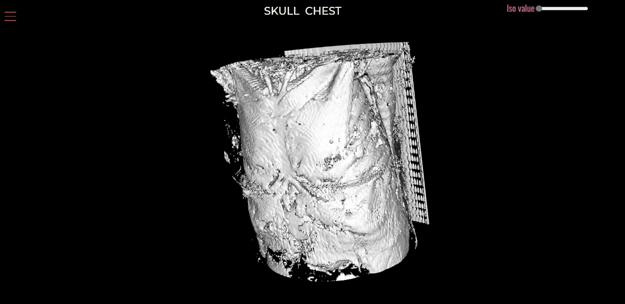 GitHub - abbas695/DICOM-image-viewer: Used in 2D and 3D Analysis ...