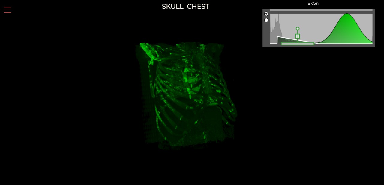 GitHub - abbas695/DICOM-image-viewer: Used in 2D and 3D Analysis ...