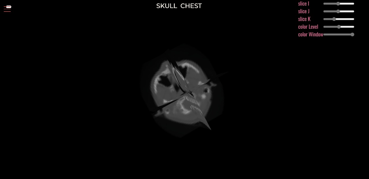 GitHub - abbas695/DICOM-image-viewer: Used in 2D and 3D Analysis ...