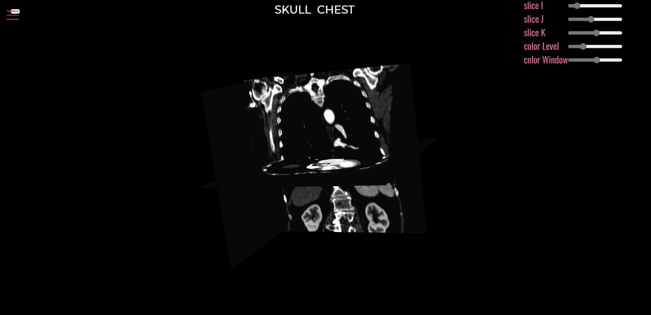 GitHub - abbas695/DICOM-image-viewer: Used in 2D and 3D Analysis ...