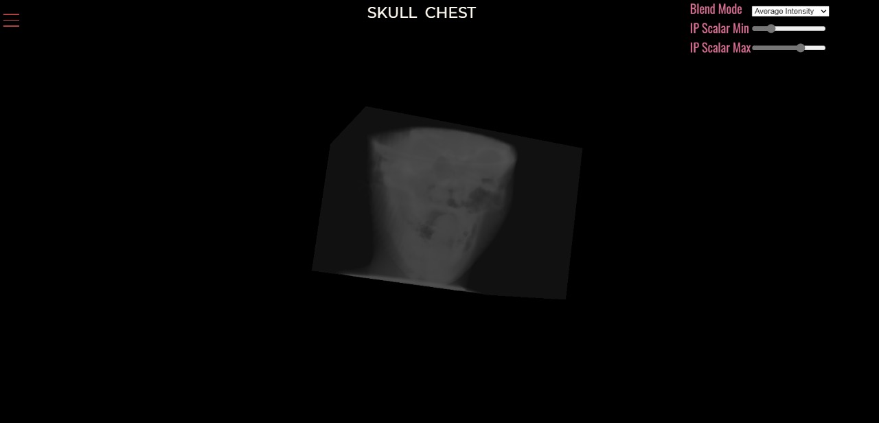 GitHub - abbas695/DICOM-image-viewer: Used in 2D and 3D Analysis (Volume Rendering) Of DICOM ...