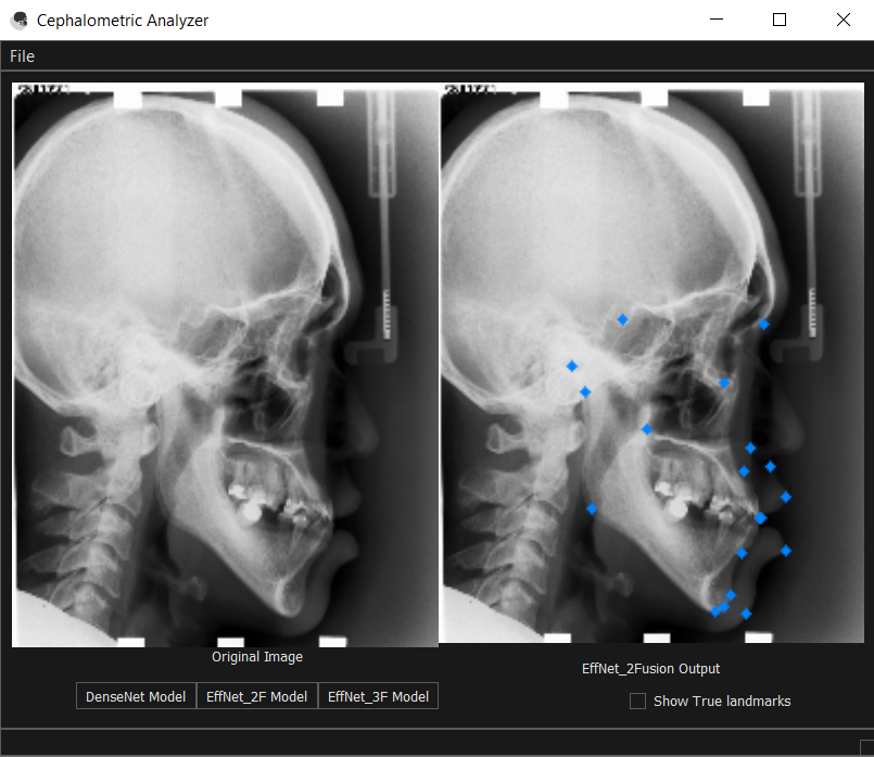 GitHub - MohamedMostafa23/Cephalometric-analysis-GUI: GUI for ...
