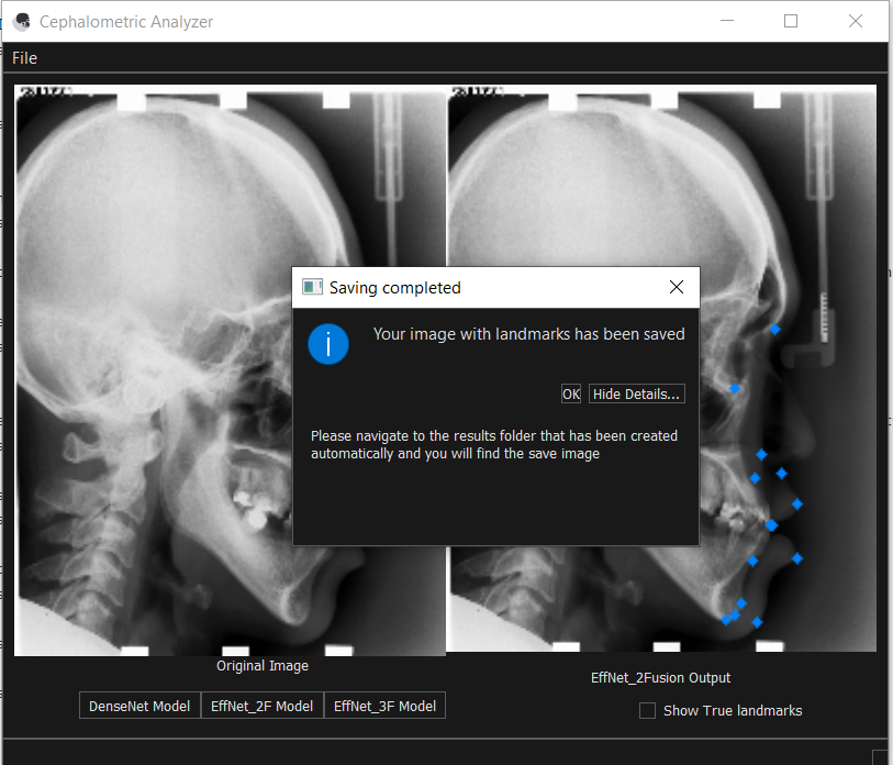 GitHub - MohamedMostafa23/Cephalometric-analysis-GUI: GUI for ...