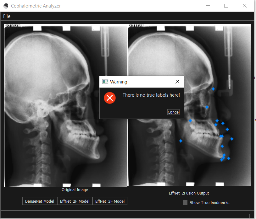 GitHub - MohamedMostafa23/Cephalometric-analysis-GUI: GUI for ...