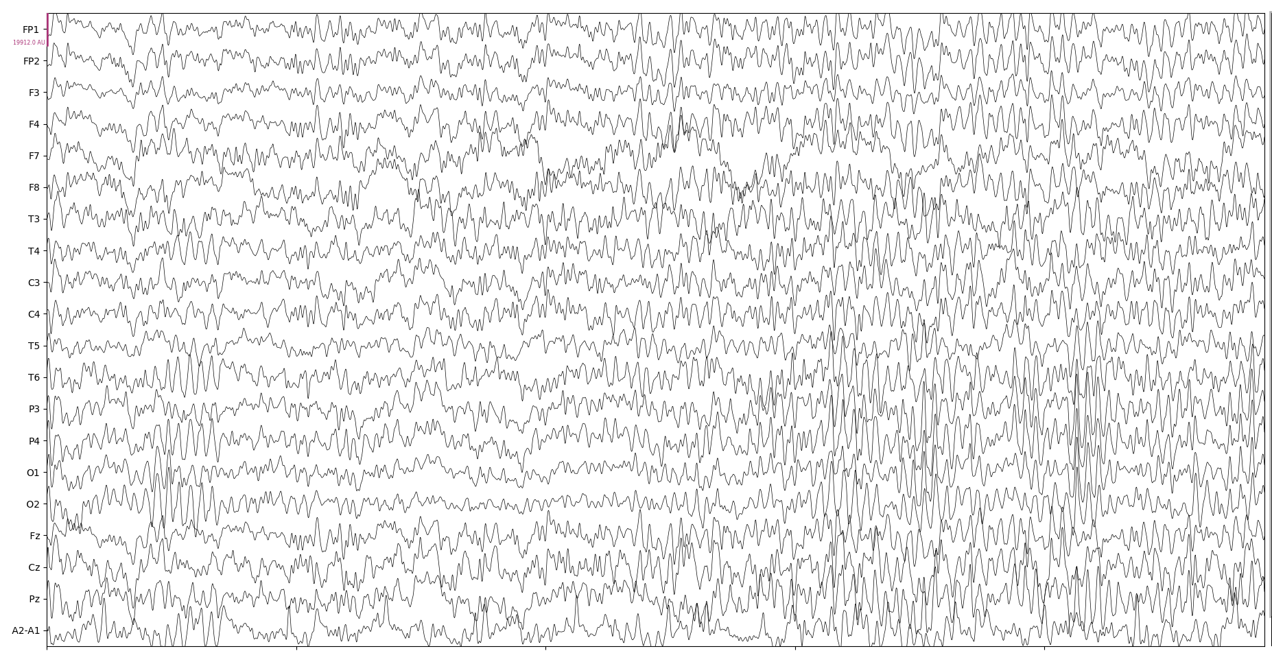 GitHub - cristinaa211/Biological_Neural_Network: Biological Neural ...