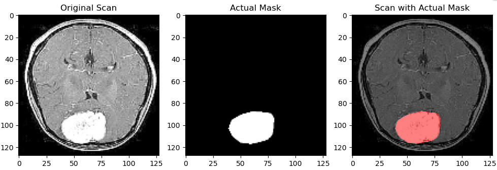 GitHub - mkldhz/Multi-Cancer-Identification-and-Segmentation-Using ...