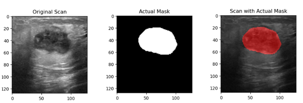 GitHub - mkldhz/Multi-Cancer-Identification-and-Segmentation-Using ...
