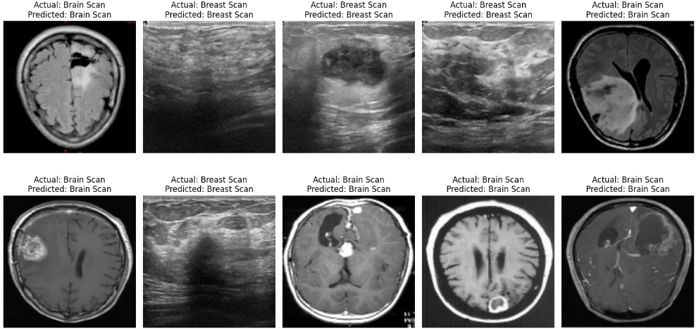 GitHub - mkldhz/Multi-Cancer-Identification-and-Segmentation-Using ...