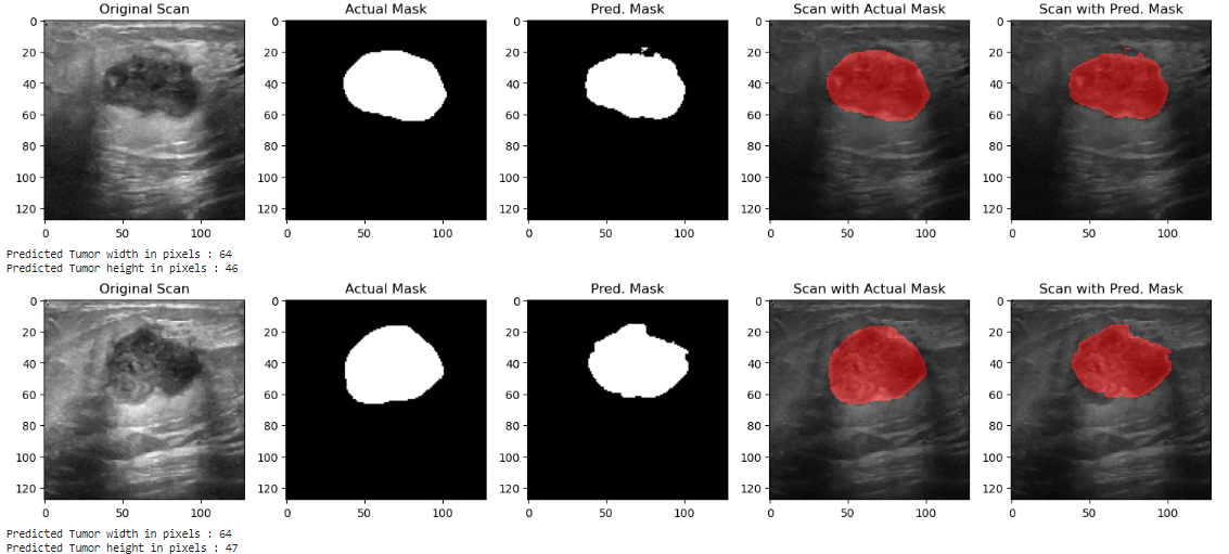 GitHub - mkldhz/Multi-Cancer-Identification-and-Segmentation-Using ...