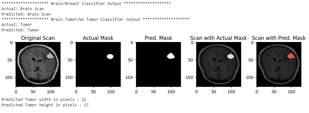 GitHub - mkldhz/Multi-Cancer-Identification-and-Segmentation-Using ...