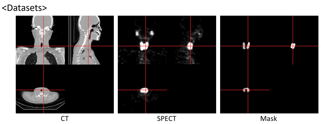 GitHub - hse801/Medical_Segmentation: Thyroid Segmentation in SPECT/CT