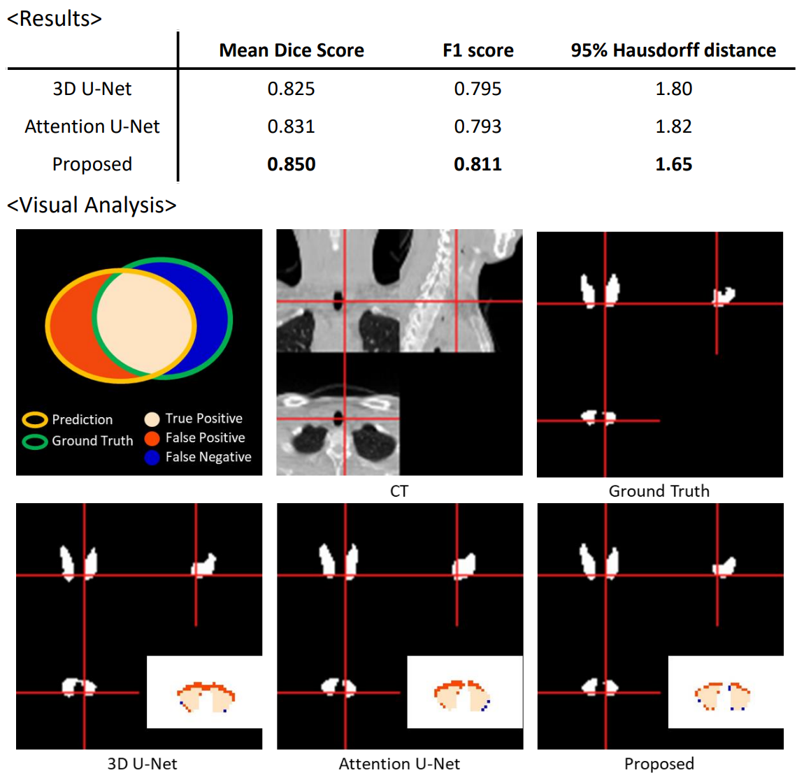 GitHub - hse801/Medical_Segmentation: Thyroid Segmentation in SPECT/CT