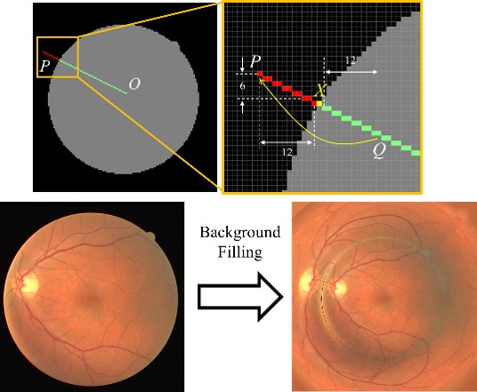 GitHub - ShuheZhang-MUMC/Fundus-image-background-filling: This MATLAB ...