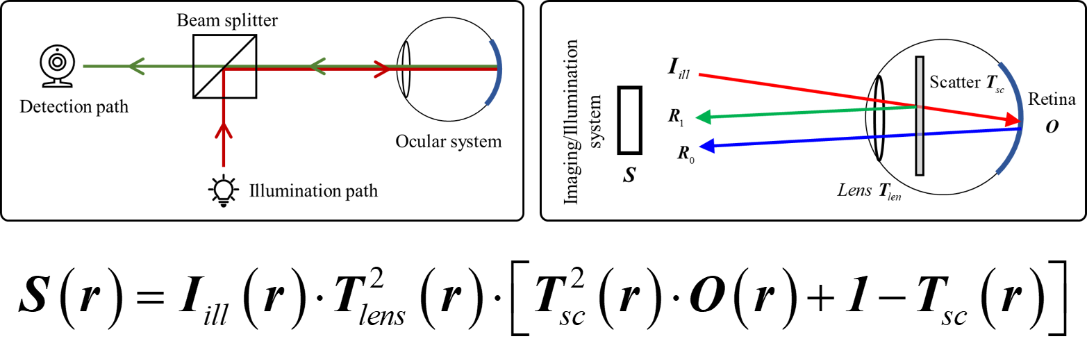 GitHub - ShuheZhang-MUMC/Double-Pass-Fundus-Reflection-model: A double ...