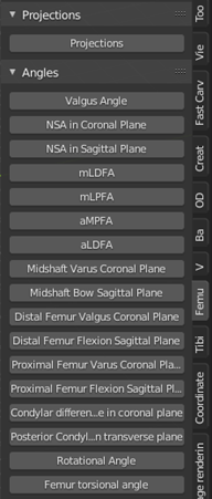 GitHub - VIVEKNITW/Femur-Pre-op-Planning-in-Blender-using-Python ...