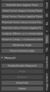 GitHub - VIVEKNITW/Femur-Pre-op-Planning-in-Blender-using-Python ...
