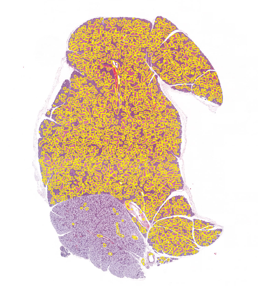 Exported Pyramidal TIFF shifted in QuPath · Issue #76 · AICAN-Research ...