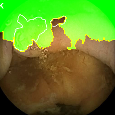 GitHub - anirudhprdhan/MISA-HUB-Auto-WCEBleedGen-Challenge: Submission for Auto-WCEBleedGen ...