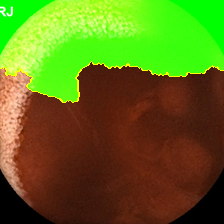 GitHub - anirudhprdhan/MISA-HUB-Auto-WCEBleedGen-Challenge: Submission for Auto-WCEBleedGen ...