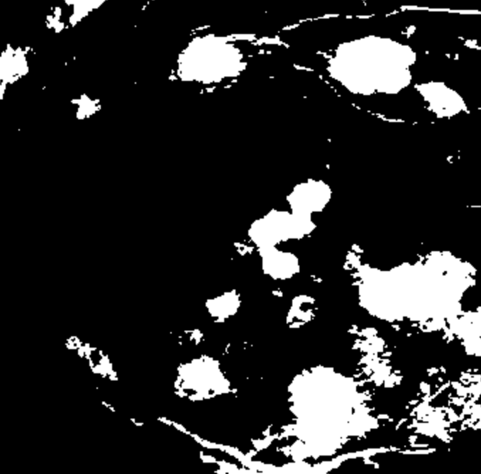 Github James Seeleukemia Retinal Scan Identifier Simple Python Script To Identify Leukemia