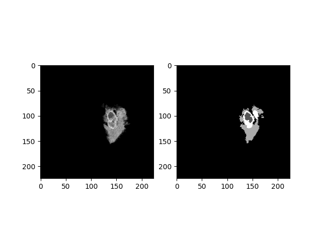 multi-class segmentation discuss · Issue #54 · JuliaWolleb/Diffusion-based-Segmentation · GitHub