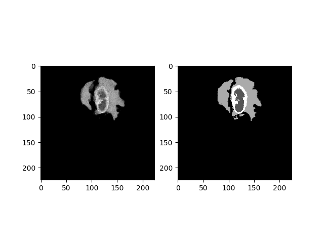Multi Class Segmentation Discuss · Issue 54 · Juliawolleb Diffusion Based Segmentation · Github