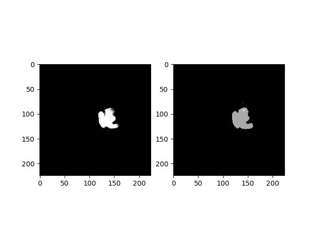 multi-class segmentation discuss · Issue #54 · JuliaWolleb/Diffusion-based-Segmentation · GitHub