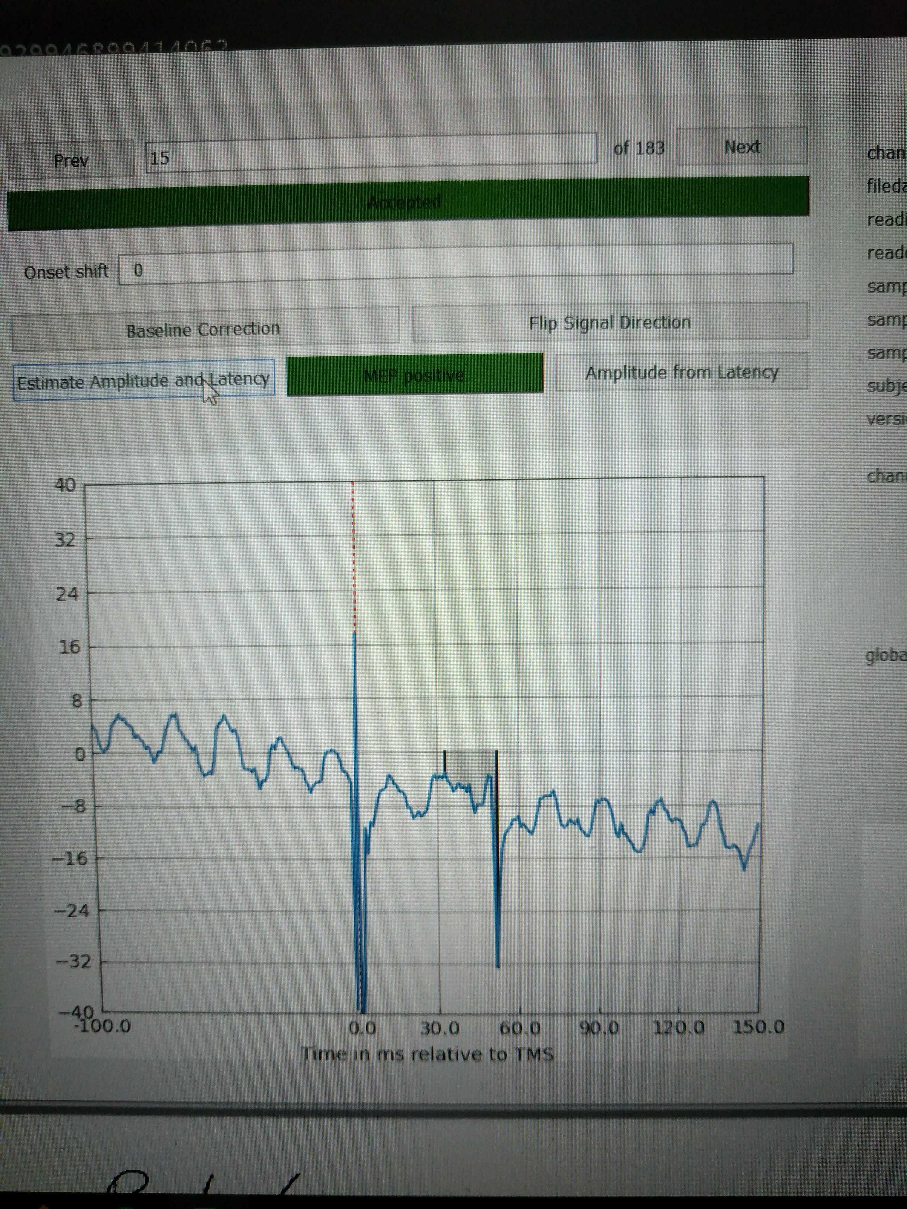 Both peaks of a MEP below or above zero · Issue #42 · neuromti/tool-offspect · GitHub