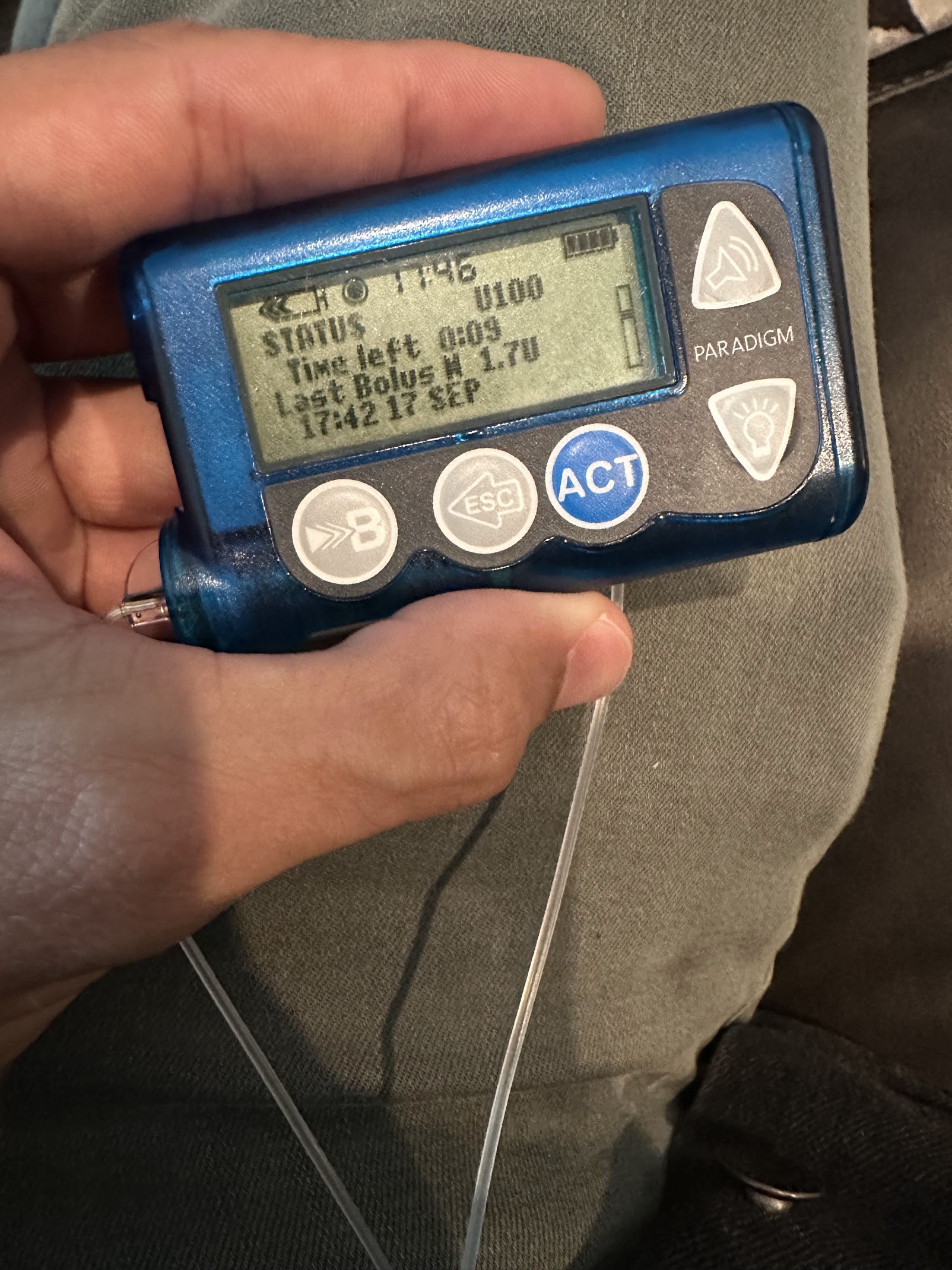 Loop suspends pump during bolus · Issue #1795 · LoopKit/Loop · GitHub