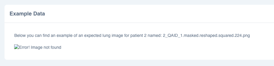 "Error! Image Not Found" (LUS example data) · Issue #444 · epfml/disco ...