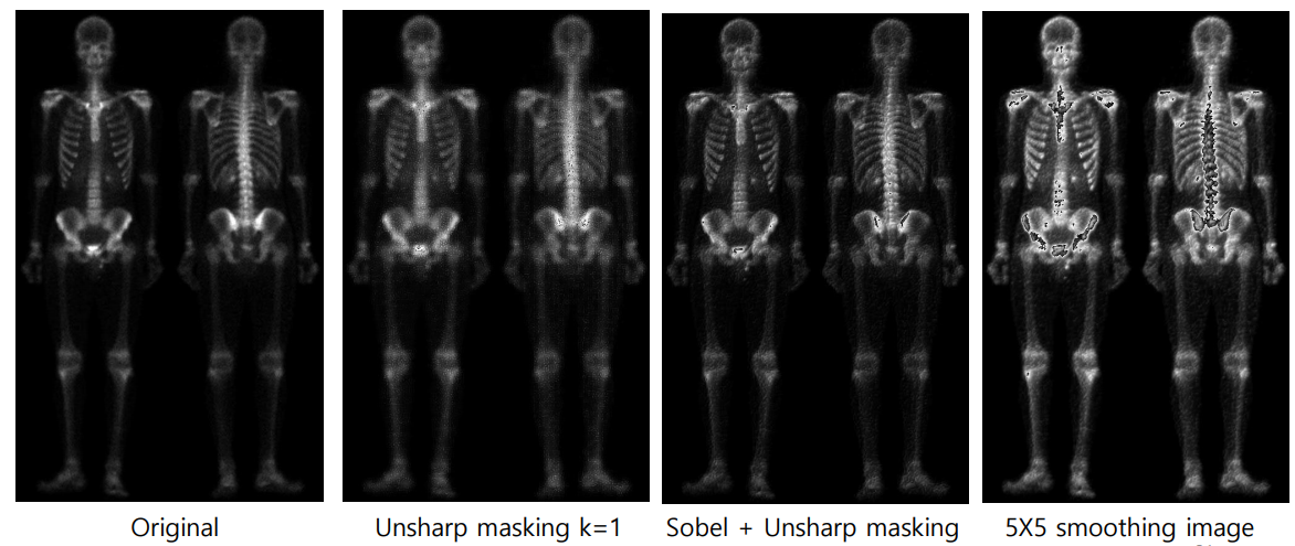 GitHub - SeongSuKim95/Digital_Image_Processing_Various_Filter