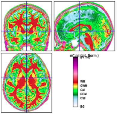 Headreco Issue: "IndexError: list index out of range" · Issue #21 · simnibs/simnibs · GitHub