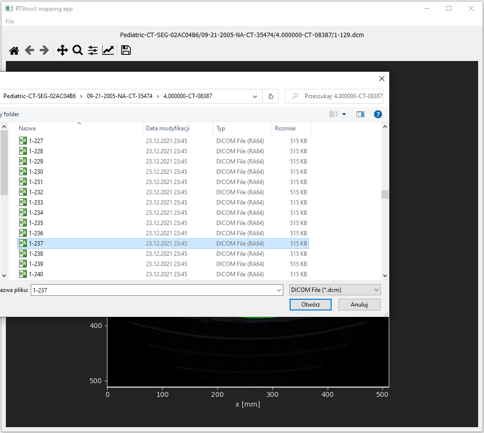 GitHub - rzelazo/RTStruct-on-CT-image: Oprogramowanie do wizualizacji struktur RTStruct ...