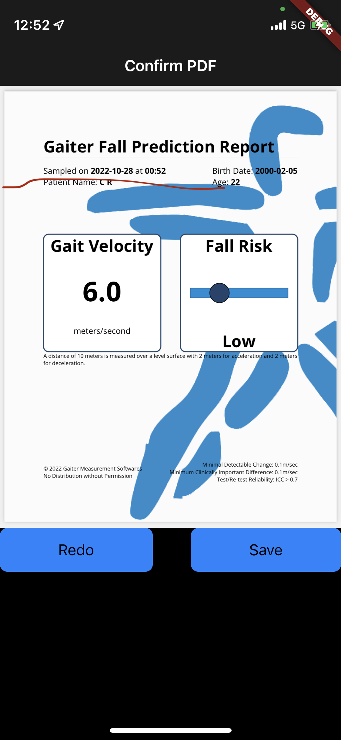 PDFView generated half zoomed view · Issue #210 · endigo/flutter_pdfview · GitHub